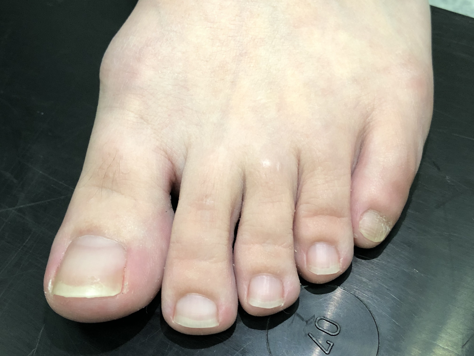 Wus Feet Links Feet Asian